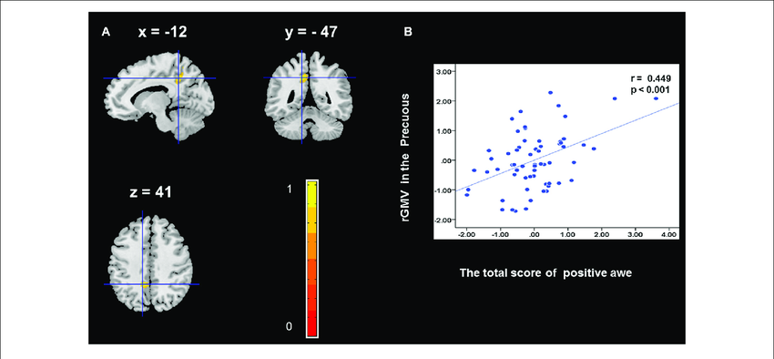 The Science of Awe – Hadron